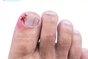 Inchaço nos dedos: o que pode ser? - Doutor Ajuda